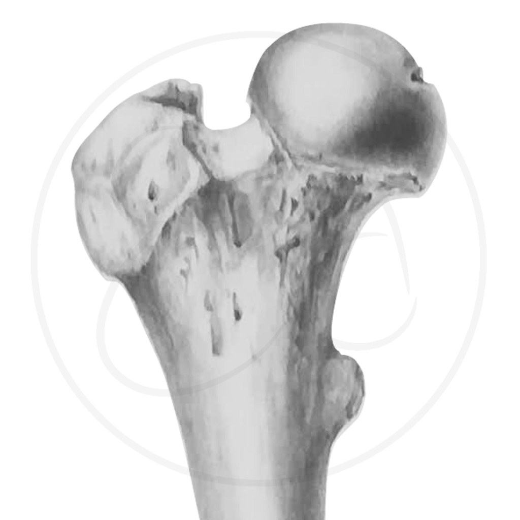 Measured Femur Drawing – Emily Adams | MedComms for BioTech, and Healthcare