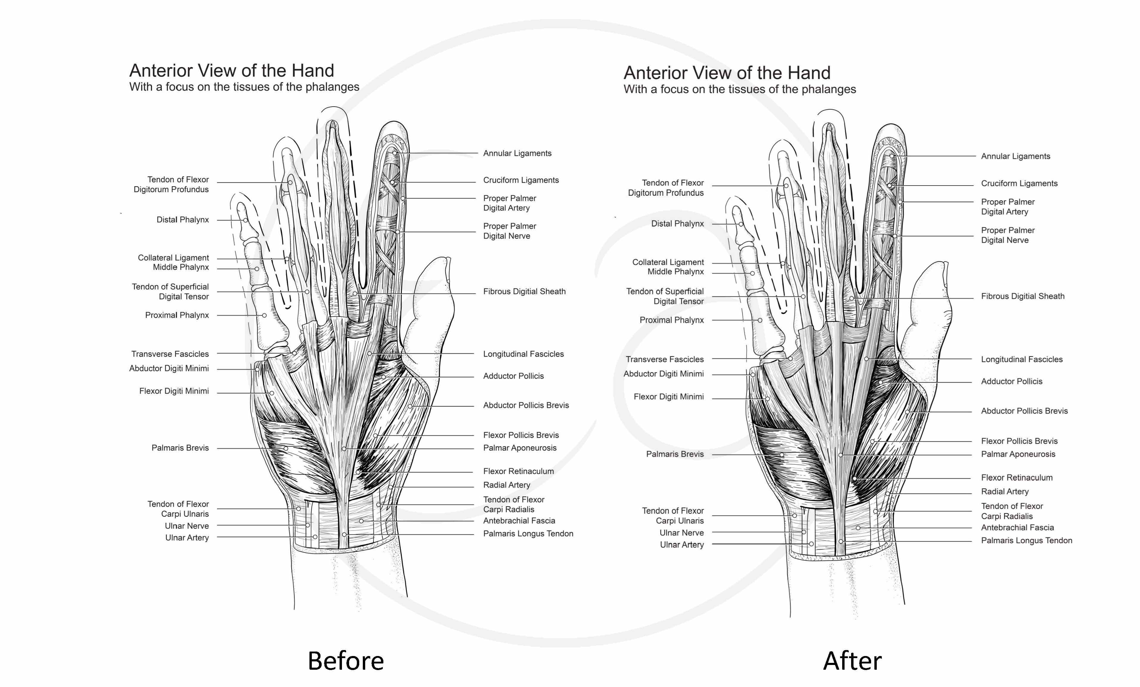 Hand Dissection Drawing – Emily Adams BioMedical Visualization and Design